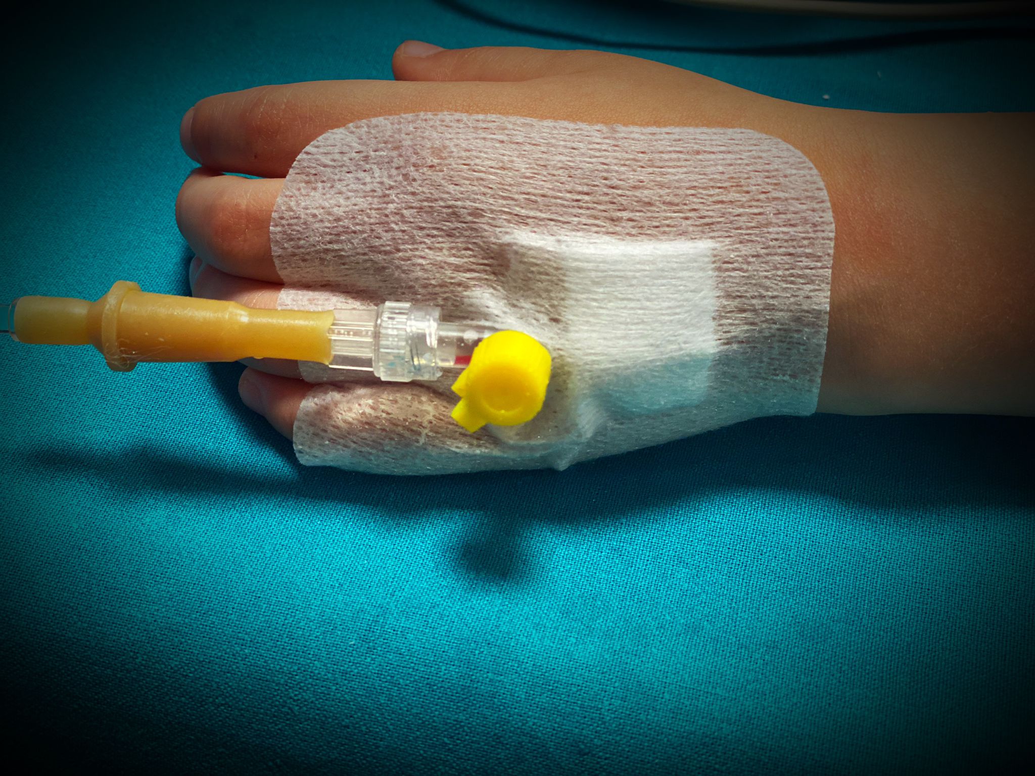 Anchetă la Spitalul Vâlcea, după ce mâna unui copil s-a infectat