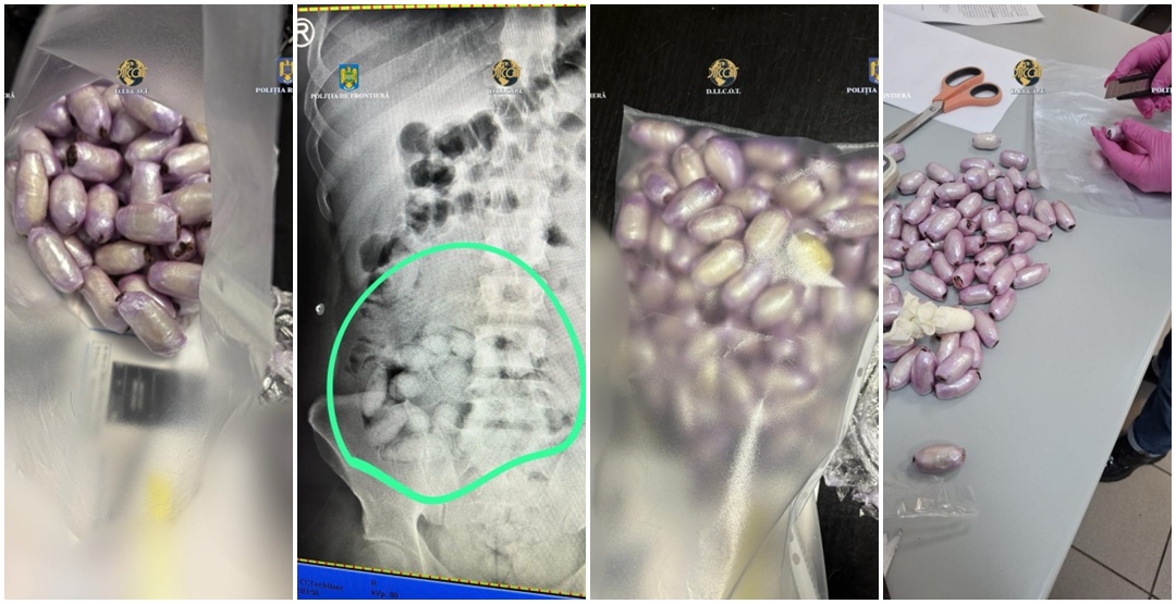 Brazilian prins cu droguri în stomac, pe Aeroportul „Henri Coandă ...